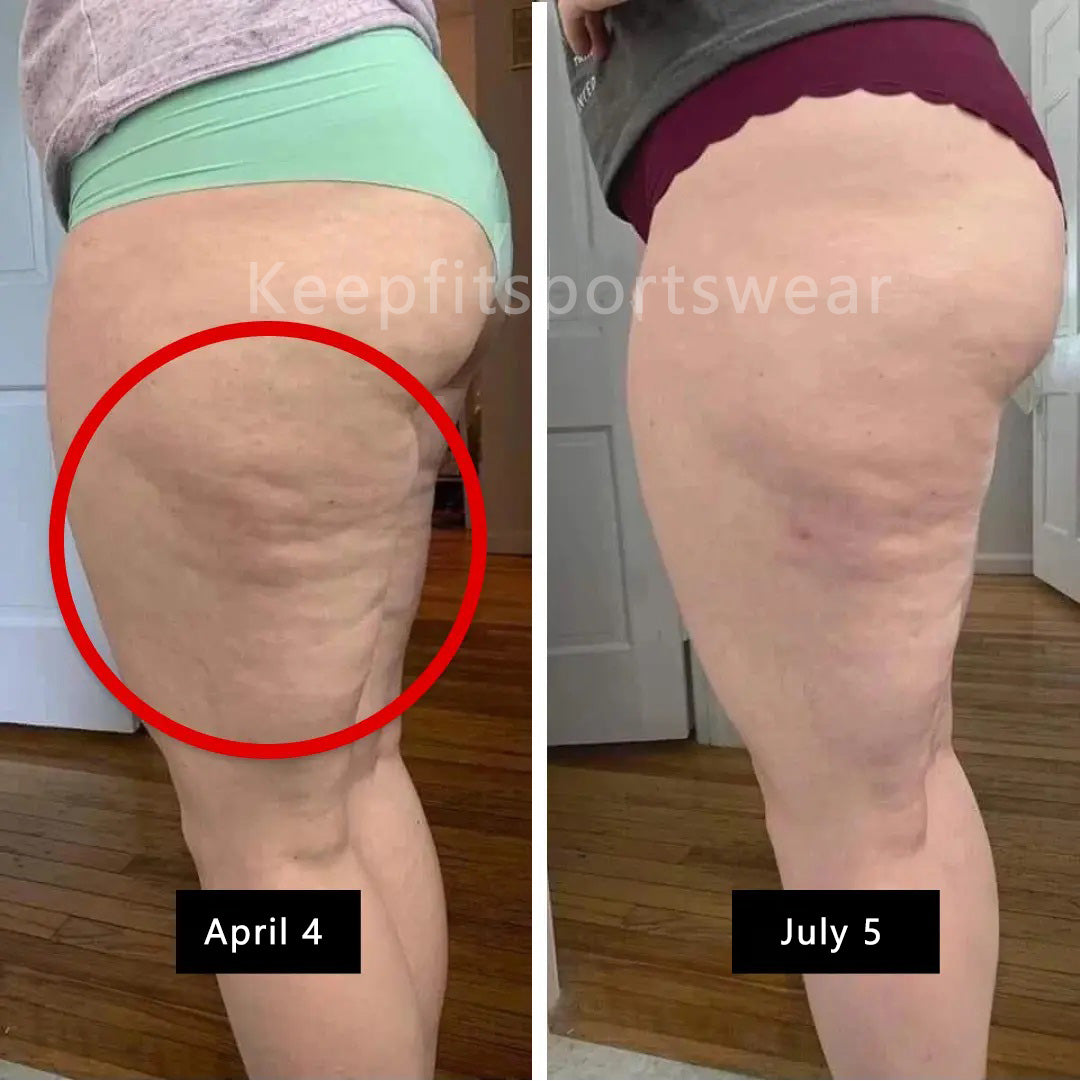 3D Compression Leggings | Burn Calories & Reduce Cellulite ...